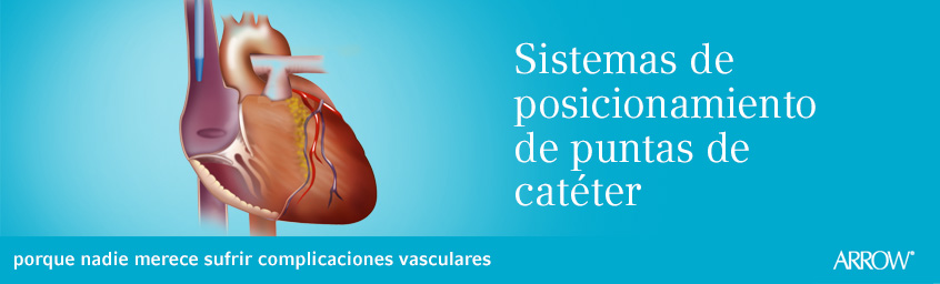 Sistemas de posicionamiento de puntas de catéter | LA | Teleflex